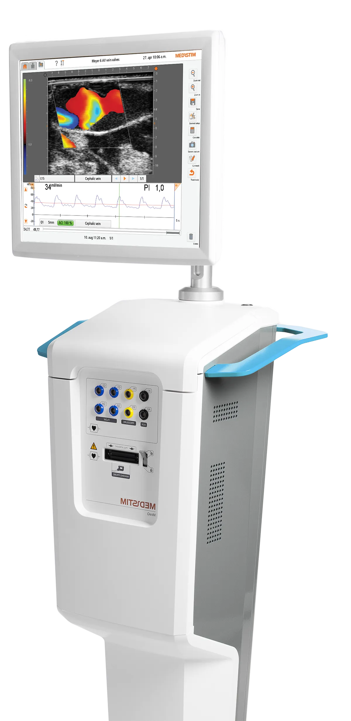 MiraQ™ Vascular: Advanced Vascular Surgery Technology | Medistim